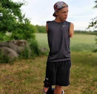 Male Amputees Hot Feet On Tumblr