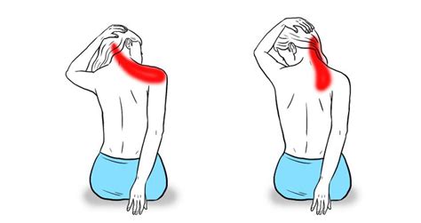11 Estiramientos para aliviar la tensión en el cuello y los hombros