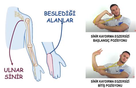 Sinir S K Mas Tedavisi Kad K Y Fizik Tedavi Merkezi