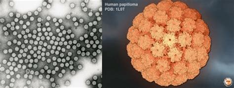 3탄 각종 사마귀와 암을 유발하는 인유두종바이러스 HPV 바로알기 미모드림의원