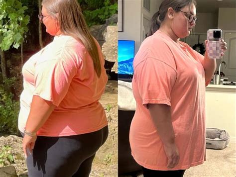 Before And After Semaglutide 6 People On The Game Changer Weight