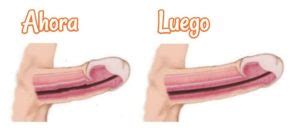 7 Métodos para Agrandar y Alargar el Pene Hazlo Crecer RÁPIDO