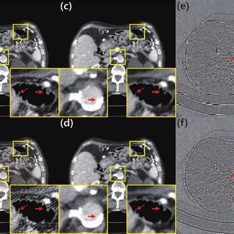 pdf wavenet a deep convolutional neural network using directional wavelets for low dose x ray