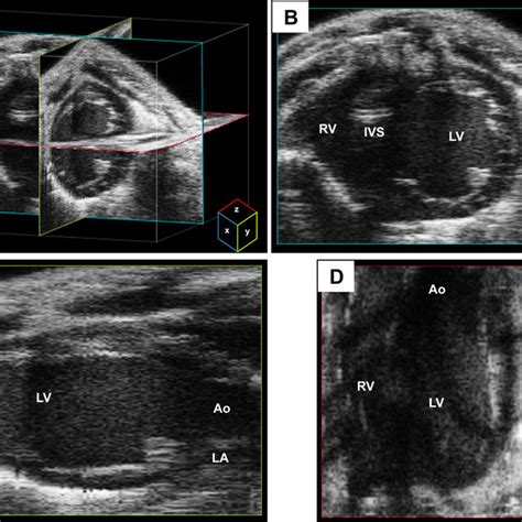 M Mode Imaging M Mode Image Of The LV Displays Dimensions Of The