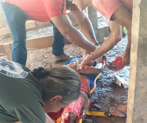 No interior do Acre indígena de 18 anos morre após ser atingido por