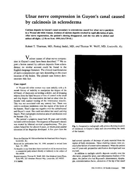 Pdf Ulnar Nerve Compression In Guyon S Canal Caused By Calcinosis In