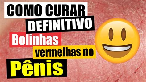 Pontinhos Vermelhos Na Glande Como Tratar Retoedu