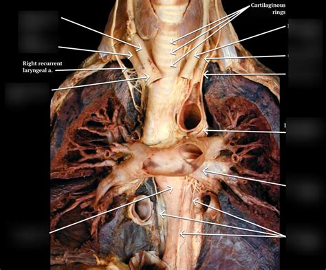 Cadaver Diagram Quizlet