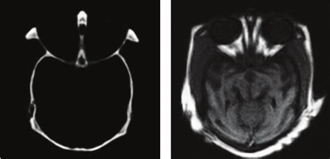 the image fusion scheme using the wavelet transform download scientific diagram
