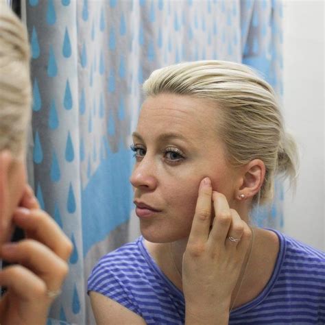 How To Cover Up A Scab With Makeup