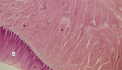 Skeletal Muscle Tongue Muscle