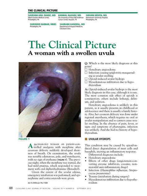 Swollen Uvula