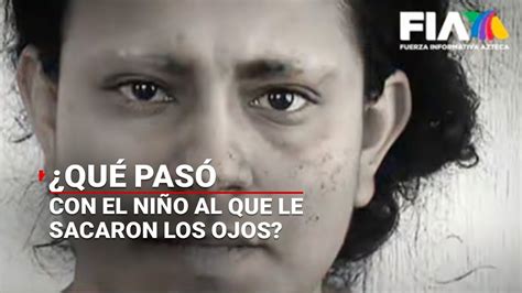 QuéPasóCon Fernandito el niño al que su madre le sacó los ojos