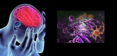 Qué es la Encefalitis tipos y prevención