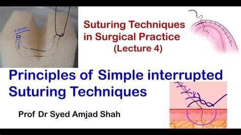Principles Of Simple Interrupted Suturing Techniques Oral