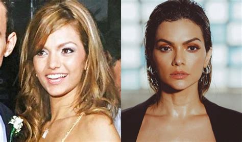 Fotos Veja o antes e depois dos famosos que fizeram harmonização