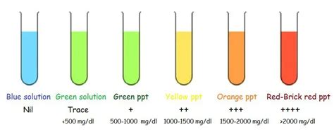 Benedict S Test Principle Reagent Preparation Procedure And