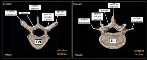 Ecograf A De La Columna Vertebral Tor Cica Dolopedia