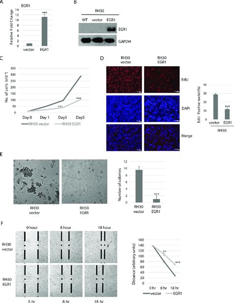 EGR1 Overexpression Reduces ARMS Cell Proliferation Anchorage