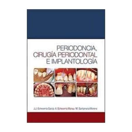 Periodoncia cirugía periodontal e implantología 1ª edición