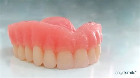 Prótese dentária removível que tipos existem e quais as vantagens e