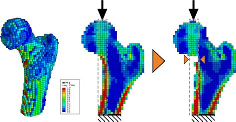 qct based finite element model with a voxel size of 3 mm × 3 mm × 3 mm download scientific