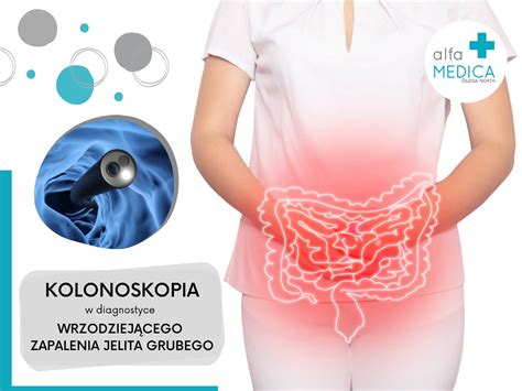 Wrzodziejące zapalenie jelita grubego kolonoskopia