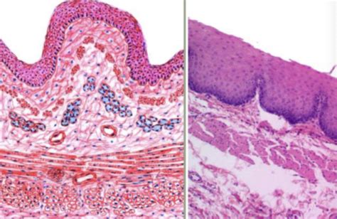 Esophagus And Stomach Flashcards Quizlet