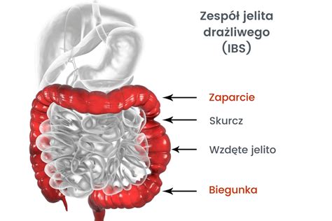 Zespół Jelita Drażliwego Przyczyny Objawy Leczenie Apteka Zdrowie