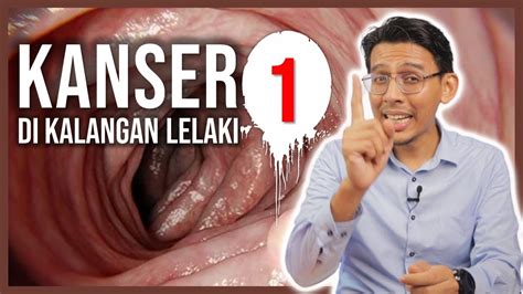 Kanser Usus Tanda Dan Saringan Kanser Kolorektal YouTube