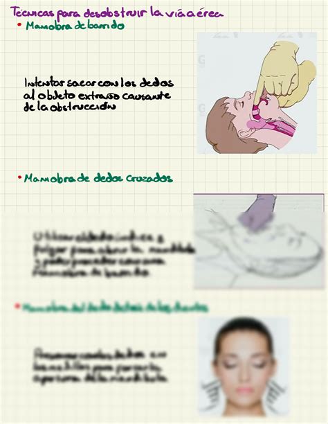 SOLUTION Tecnicas Basicas Para El Manejo De La Via Aerea Studypool