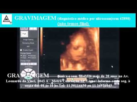 Gravimagem Ultrassom Morfol Gico D D Em Gravidez Semanas