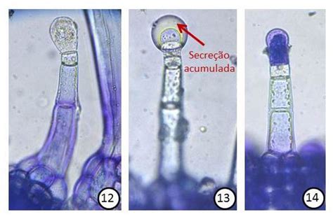 Visualiza O De Tricomas Anatomianaescola
