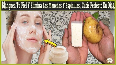 Elimina Las Espinillas Manchas Y Regenera La Piel A Profundidad