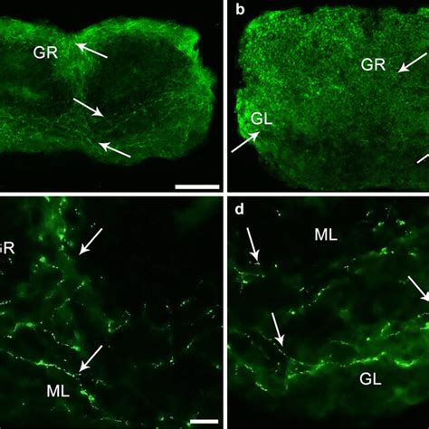 Aj Photomicrographs Of Transverse Sections Through The Brain Of S