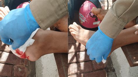 Antes e depois veja como era e como ficou Brumadinho após tragédia