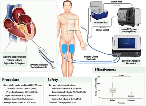 Frontiers First In Man Application Of Liwen RF Ablation System In