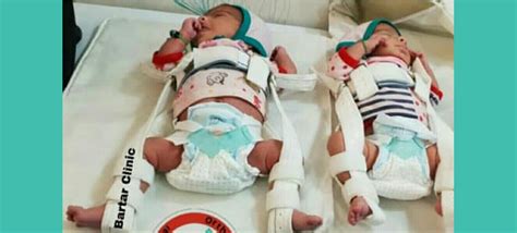 دررفتگی لگن مادرزادی کلینیک ارتوپدی فنی برتر