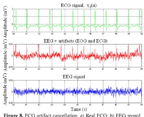 figure 8 from artifact removal from eeg signals using adaptive filters in cascade semantic scholar
