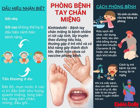 Infographic Đừng chủ quan với bệnh tay chân miệng ở trẻ em DNTT online