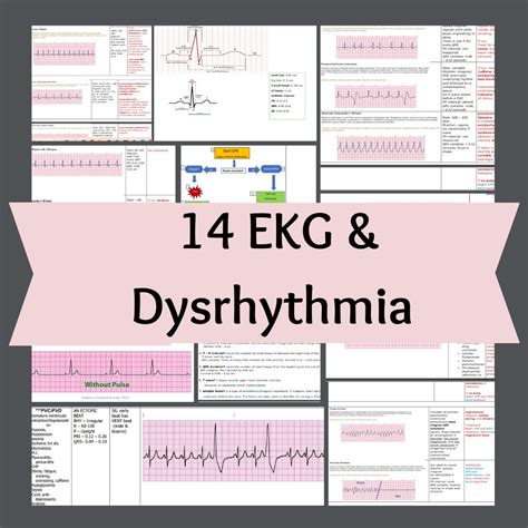Cardiac Ekg Interpretation Nursing School Student RN Ecg Dysrhythmias