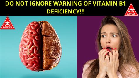 Top 5 Warning Signs Of Vitamin B1 Deficiency Know These Before It Is