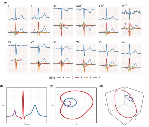 ecg for patient 8 in the ptb xl database beat nº9 a 12 lead download scientific diagram