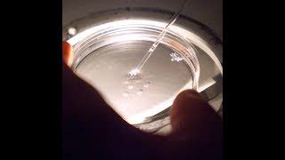Human Egg Cell Visible