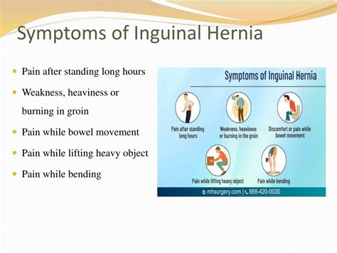 PPT Inguinal Hernia Types Symptoms Diagnosis Treatments