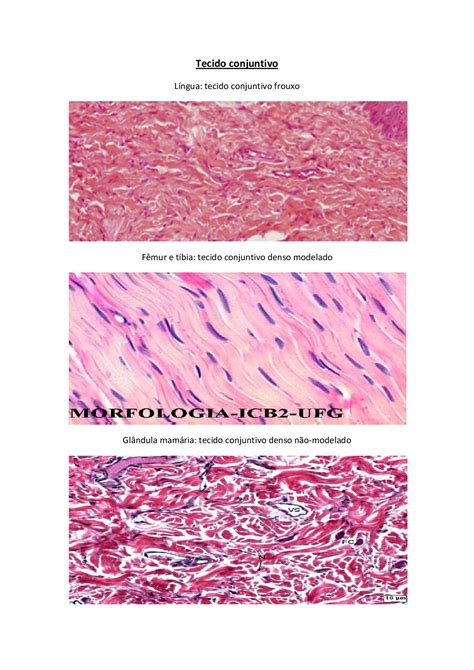 HISTOLOGIA Tecido Conjuntivo E Conjuntivo Propriamente Dito Tecido