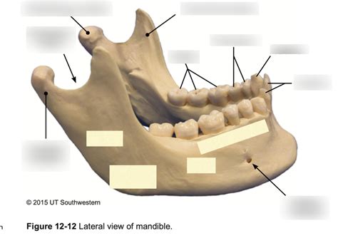 Lab 12 Lateral View Of Mandible Diagram Quizlet