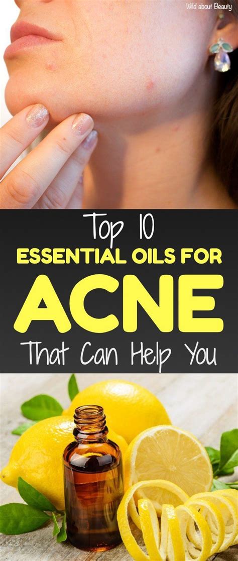 Top 10 Essential Oils For Acne That Can Help You Essential Oils For