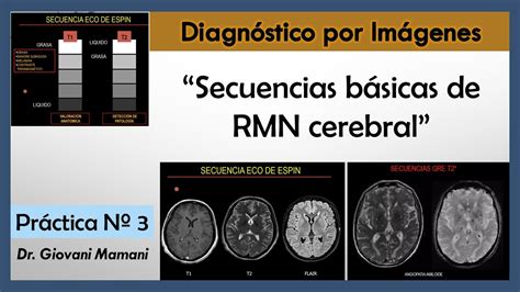 Práctica Nº 3 Secuencias básicas de RMN cerebral YouTube