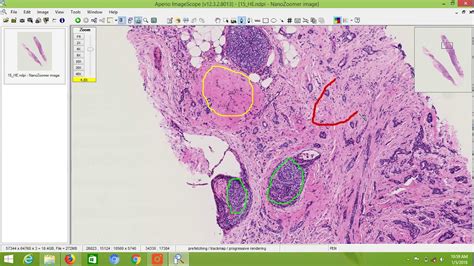 image annotation using image scope youtube